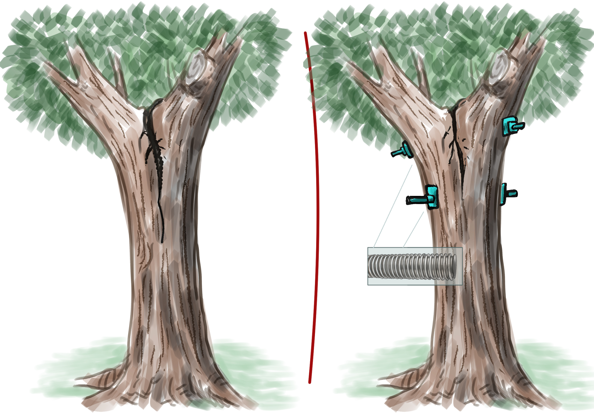 Cabling and Bracing - Arbormax Tree Service